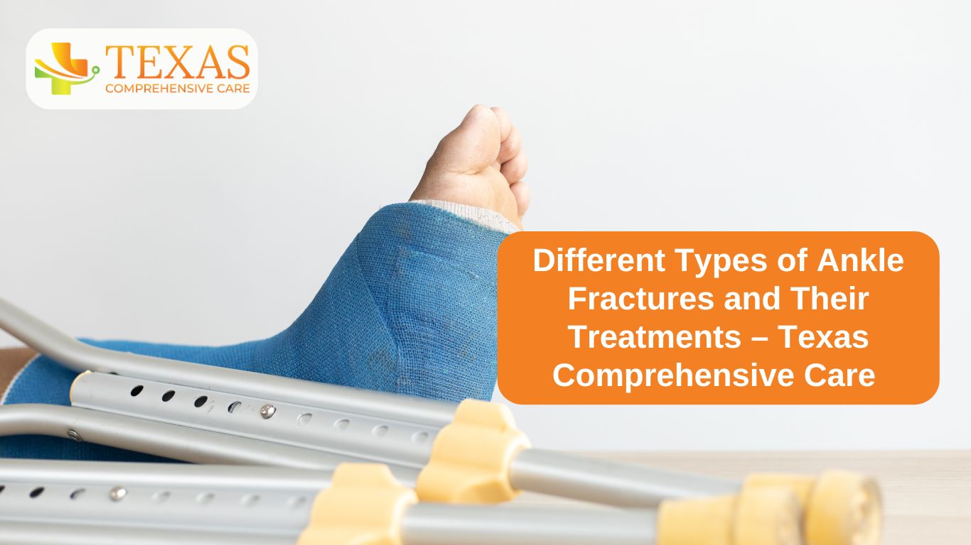 Different Types of Ankle Fractures and Their Treatments – Texas ...
